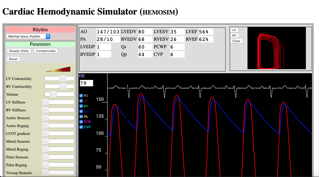 Cardiac Hemodynamic Simulator (HEMOSIM) – CathLab.com