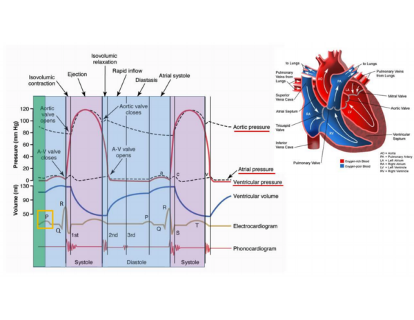 Wigger’s Diagram – CathLab.com